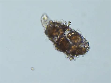 Found Among Lichen No Idea What Im Looking At Rmicroscopy