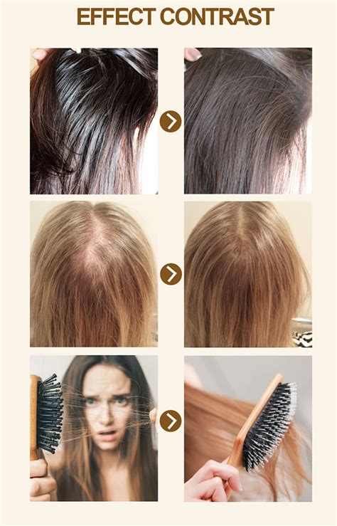 Hair Growth Shampoo For Thickener Regrowth Fast Growth Hair Serum Treatments Oil For Anti Hair