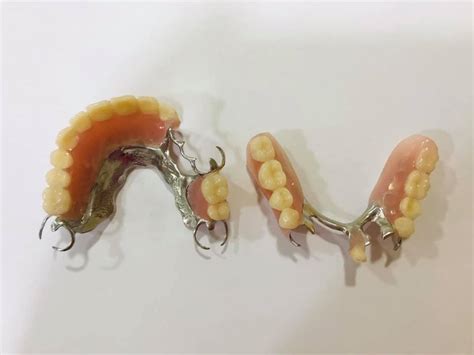 🌺🌺🌺Халамж болон тэтгэврийн ТУЯА ДЕНТ шүдний эмнэлэг