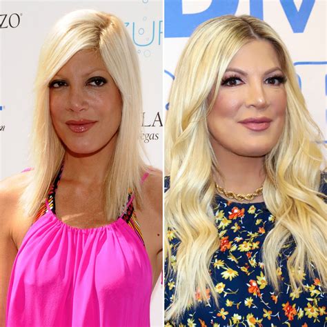 Did Tori Spelling Get Plastic Surgery Her Response