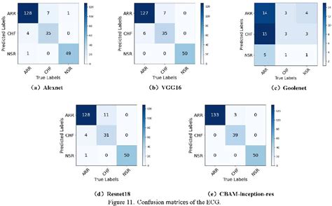 Figure 10 From Classification Of Welding Defects Based On Convolutional Neural Networks And