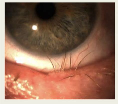 Ppo Iii Final Flashcards Quizlet