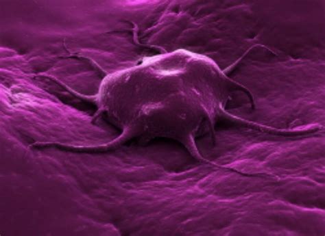 피플앤바이오 헬스케어 [충격 암세포 근육 만들어 다른 장기로 이동] 하나의 암세포가 이분법에 의하여 20번 정도 분화를 하게 되면 종양의 크기가 약 1mm정도가