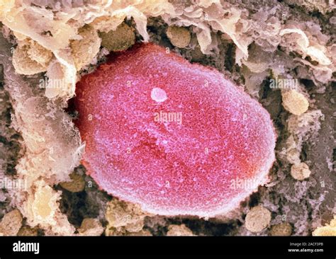 Cell Nucleus Coloured Scanning Electron Micrograph SEM Of A Section Through A Liver Cell