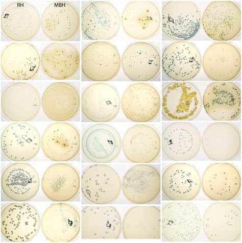 Primary Isolation On Chromogenic Media Vaginal Samples Were Serially