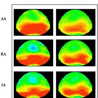 Grand Average Topographic Scalp Maps Showing ERP Components For The Download Scientific Diagram