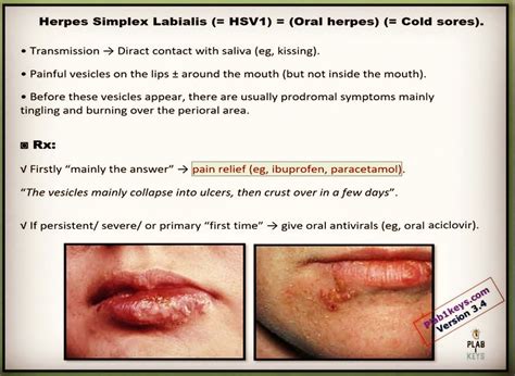 Plab 1 Keys • Exam Oriented Notes High Yield Coloured