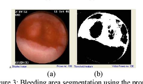 Figure 1 From Detection Of Bleeding Patterns In Wce Video Using Multiple Features Semantic Scholar