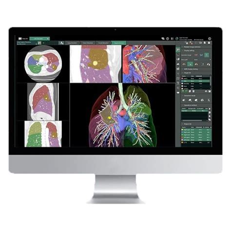 Synapse 3d Fujifilm Pulmo Care