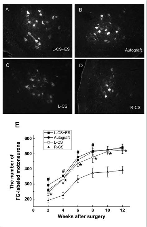 Micrographs Following Fluorogold Retrograde Tracing In The L Cs Es