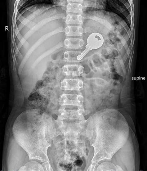 ყველაფერი მედიცინაზე Added A New Photo ყველაფერი მედიცინაზე