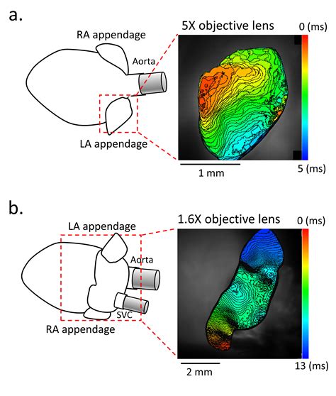 Electrophysiological Assessment Of Murine Atria With High Resolution