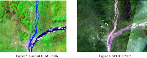Confluence Of Subclavian Vein And Internal Jugular Vein Semantic Scholar