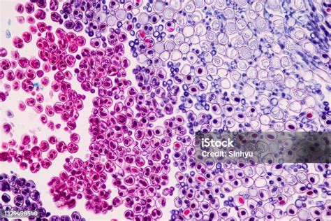 포자 를 가진 호스트 세포는 교육을 위한 현미경의 밑에 나무 안쪽에 있습니다 균사에 대한 스톡 사진 및 기타 이미지 균사 발효 과학 Istock