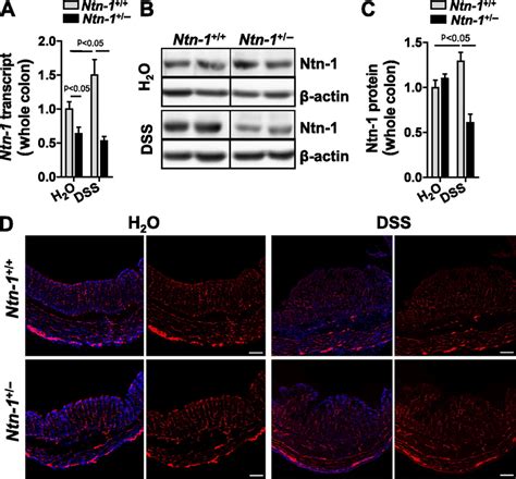Netrin 1 Expression And Enteric Neuronal Patterning In Mice With Download Scientific Diagram
