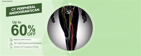 Ct Peripheral Angiogram Scan Price Ct Peripheral Angiogram Scan Starts At Rs 6000 Aarthi