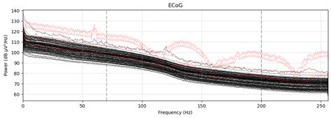Ecog Preprocessing — Ecog Tutorials Documentation