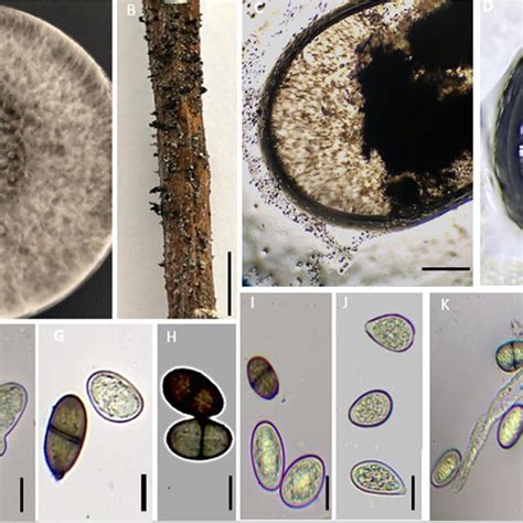 Morphological Features Of Curvularia Hawaiiensis A Colony On Pda Download Scientific