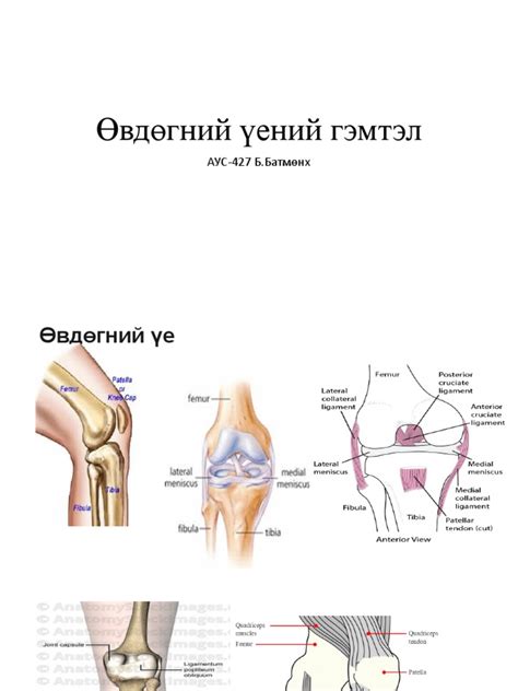 Өвдөгний үений гэмтэл Pdf