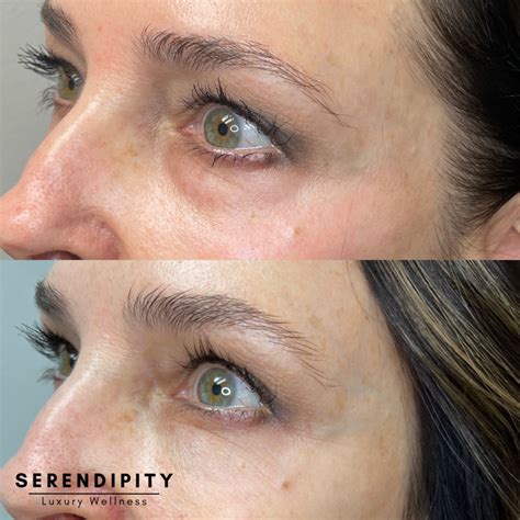 Exomes Houston Tx Stem Cell Therapy Sugar Land Serendipity