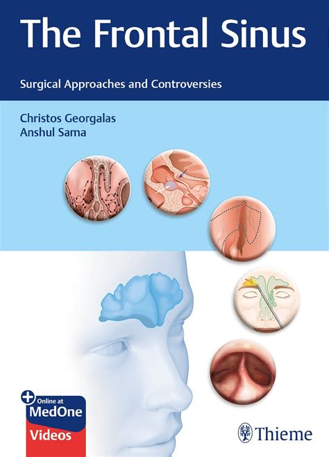 The Frontal Sinus Jetzt Bestellen Im Thieme Webshop 9783132400528