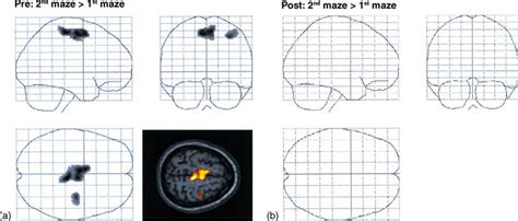 Evaluation Of Testre Test Effects During Fmri Of Complex 3d Download Scientific Diagram