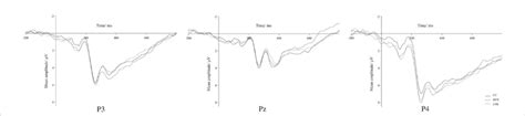 P3 Waveforms In The Parietal Region Download Scientific Diagram
