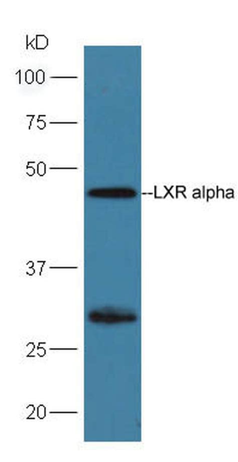 Lxr Alpha Lxr Beta Polyclonal Antibody Bs 10311r