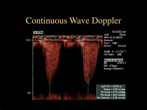 Ppt Echo Physics Powerpoint Presentation Free Download Id1714244