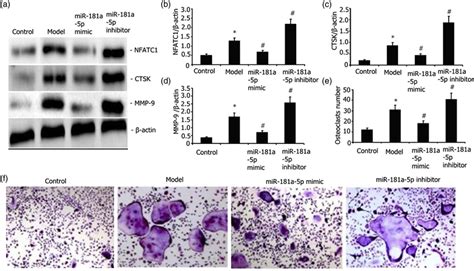 Influence Of Mir 181a 5p Mimic On The Lps Mediated Capacity Of Raw
