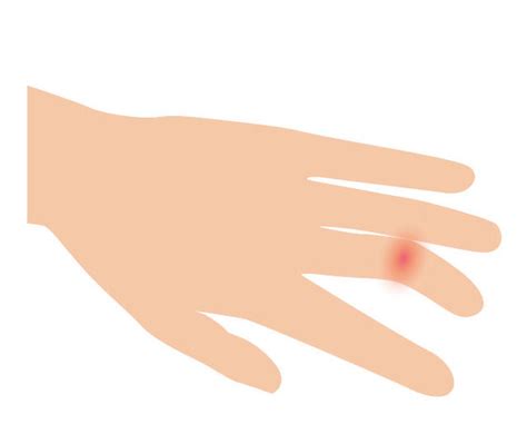 아이플러스 후기와 건강정보 손가락 통증