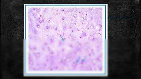 Solution Tejido Conectivo Cartilaginoso Studypool