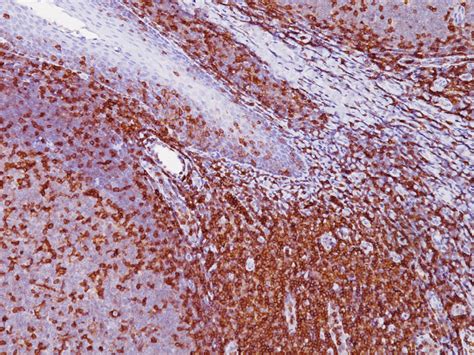 Cd43 Antibody Biocare Medical