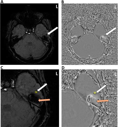 Example Of A Region Of Interest Selection Performed By The Region Download Scientific Diagram
