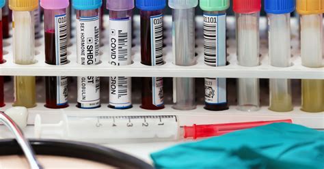 Medical Labs Finding Success With Wireless Temperature Sensors Swift Sensors