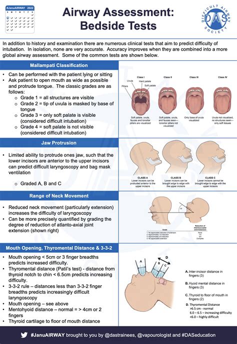 Airway Assessment Bedside Tests One Pager