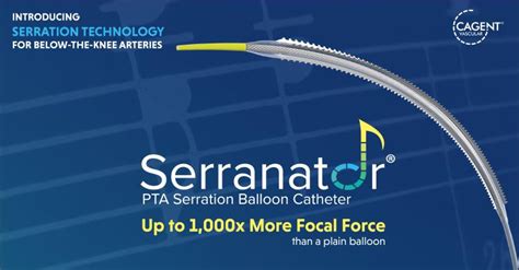 William Hankins On Linkedin Serranator Cli Btk 20 Comments