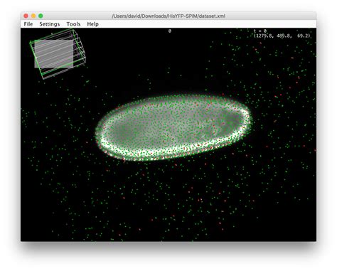 Bigstitcher Interest Point Management Imagej