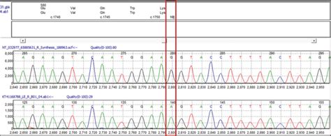 Congenital Leptin Receptor Deficiency A Novel Leptin Receptor Gene