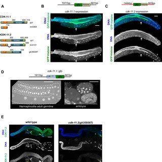 Germ Line Defects In Cdk Tm Hermaphrodites Are Restricted To Download Scientific