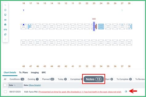 A Guide To The Odontogram Charting Carestack