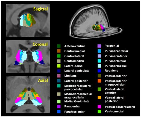 three dimensional atlas of the thalamic subnuclei segmentation