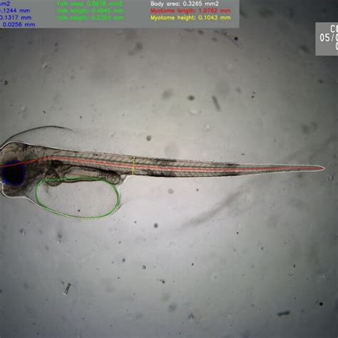 An Automatically Rendered Microscopy Image Of An Atlantic Cod Larvae 3
