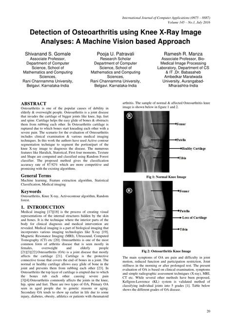 Pdf Detection Of Osteoarthritis Using Knee X Ray Image Analyses A Machine Vision Based Approach