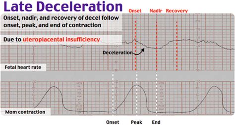 Reproductive System Flashcards Quizlet