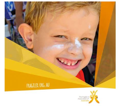Fragile X Awarness Day 2014 Ageless Radiance Club