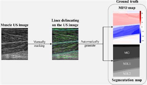 Figure 2 From Full Spatial Muscle Fiber Orientation Estimation From Ultrasound Images Using A