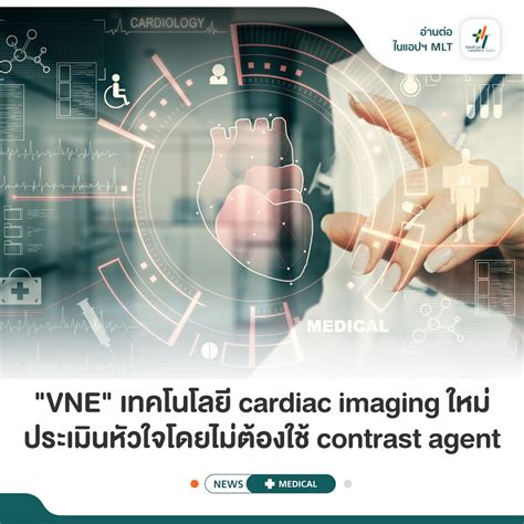 Medical Leaders Thailand Mlt กลุ่มการศึกษาจาก University Of Virginia ได้พัฒนาเทคนิคการถ่าย