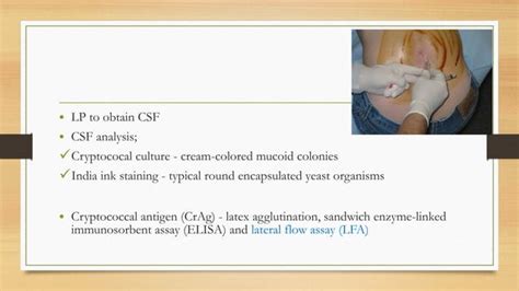 Case Presentation Cryptococcal Meningitis Ppt