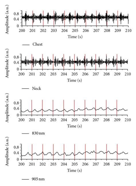 Measurement 4 Accelerometer And Ppg Signals Measured Inside The Mri Download Scientific